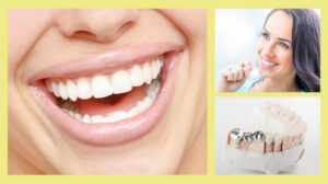 The Importance of Tooth Space Closure in Dental Care